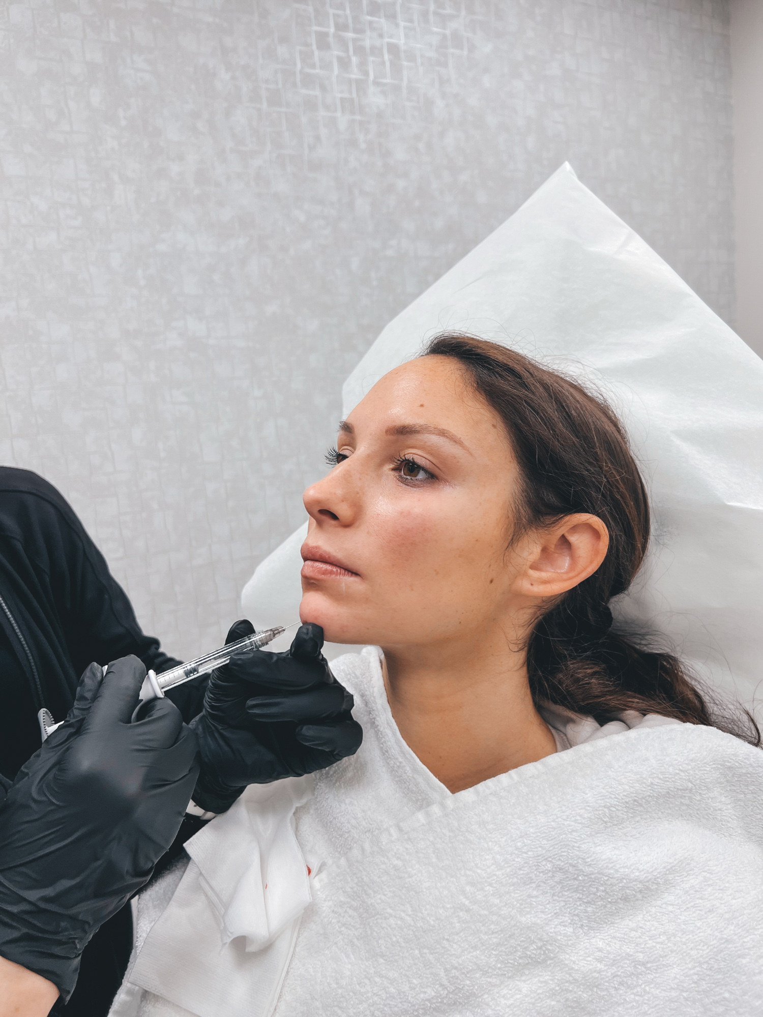 Sculpt Your Profile: The Transformative Benefits of Chin and Jawline ...